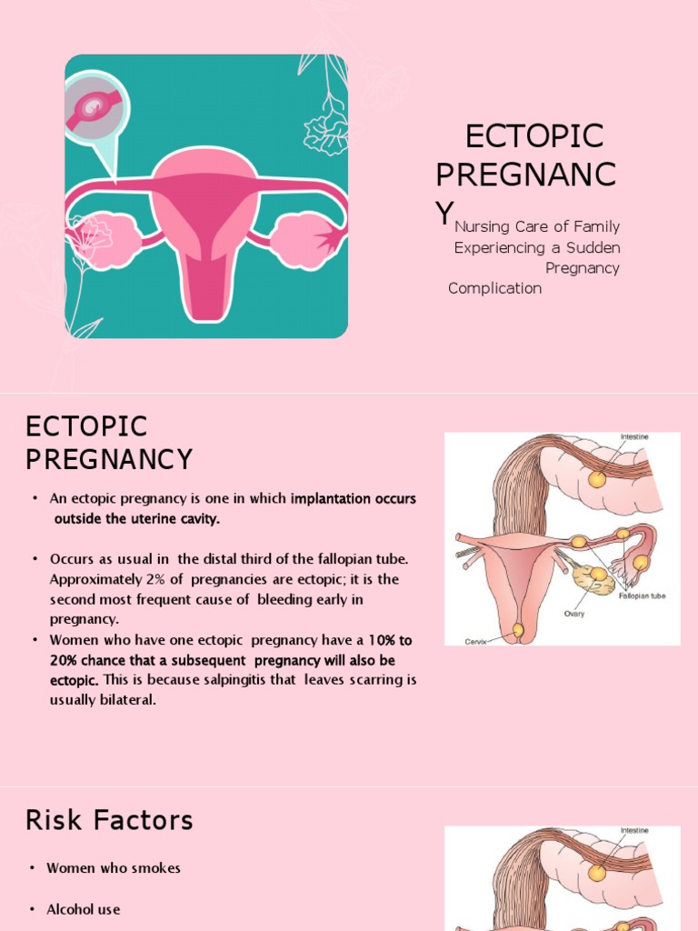 ECTOPIC PREGNANCY.pptx | PDF | Pregnancy | Coagulation