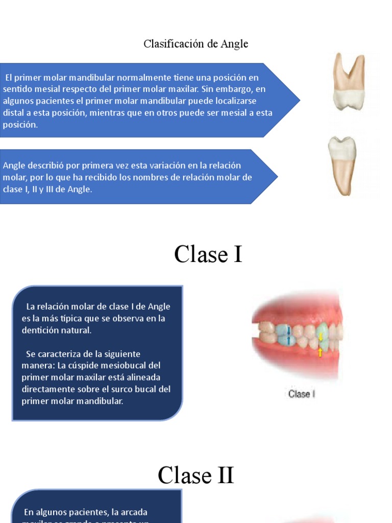 Clasificación de Angle | PDF | Salud y bienestar
