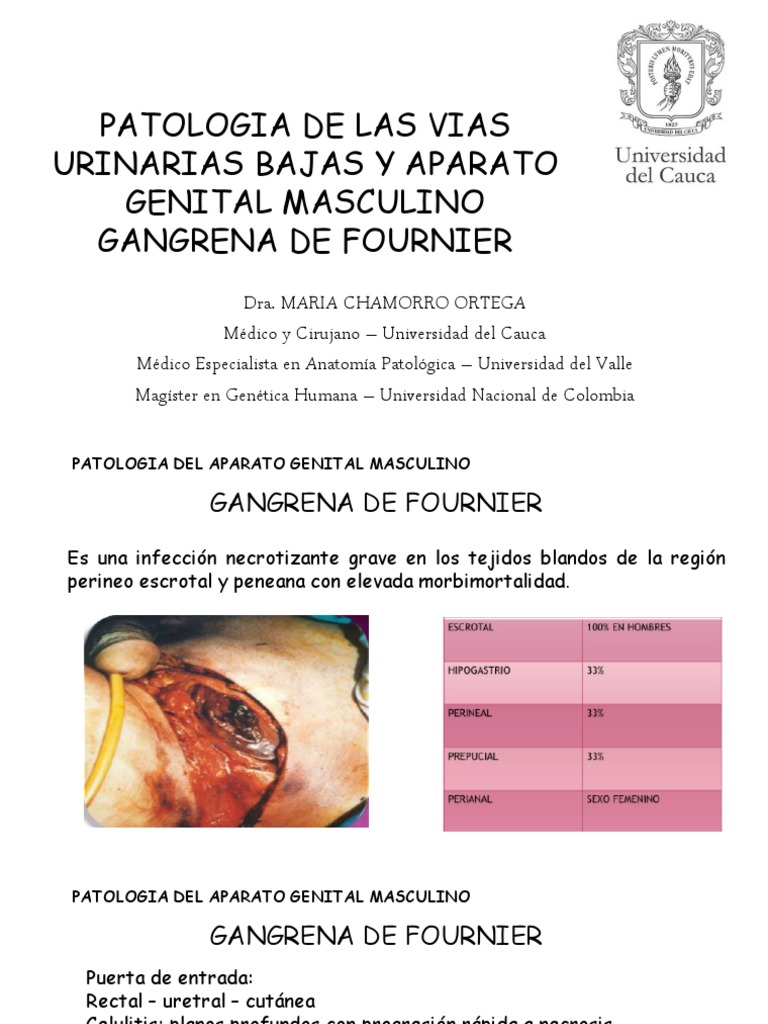 Gangrena de Fournier en Varones | PDF