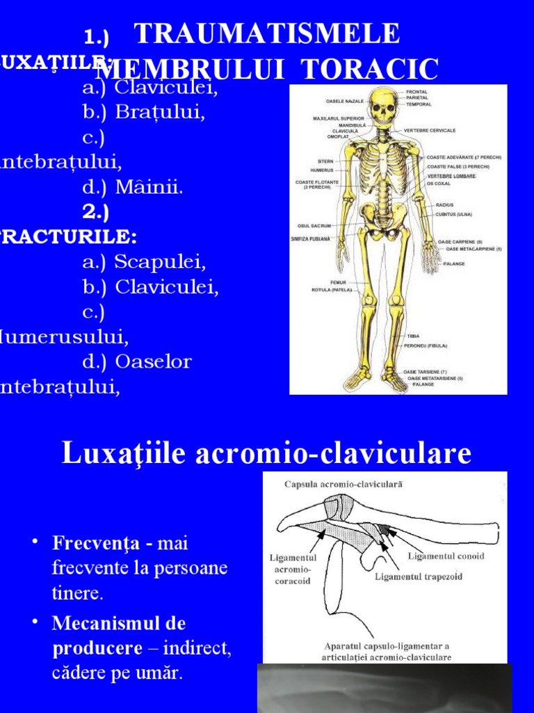 Traumatismele Membrului Toracic ROM | PDF