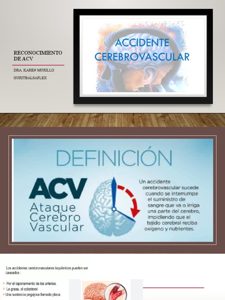 Reconocimiento de ACV Isquémico y Hemorrágico | PDF | Salud y bienestar