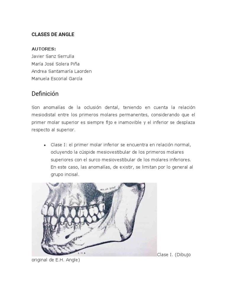 Clasificación de las Clases de Angle | PDF | Ramas de Odontología ...