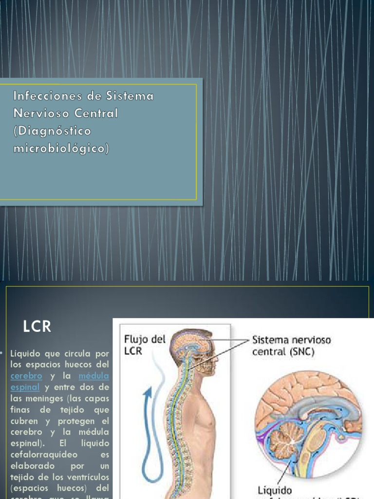 Infecciones de Sistema Nervioso Central | PDF | Fluido cerebroespinal ... Infecciones de Sistema Nervioso Central | PDF | Fluido cerebroespinal ...