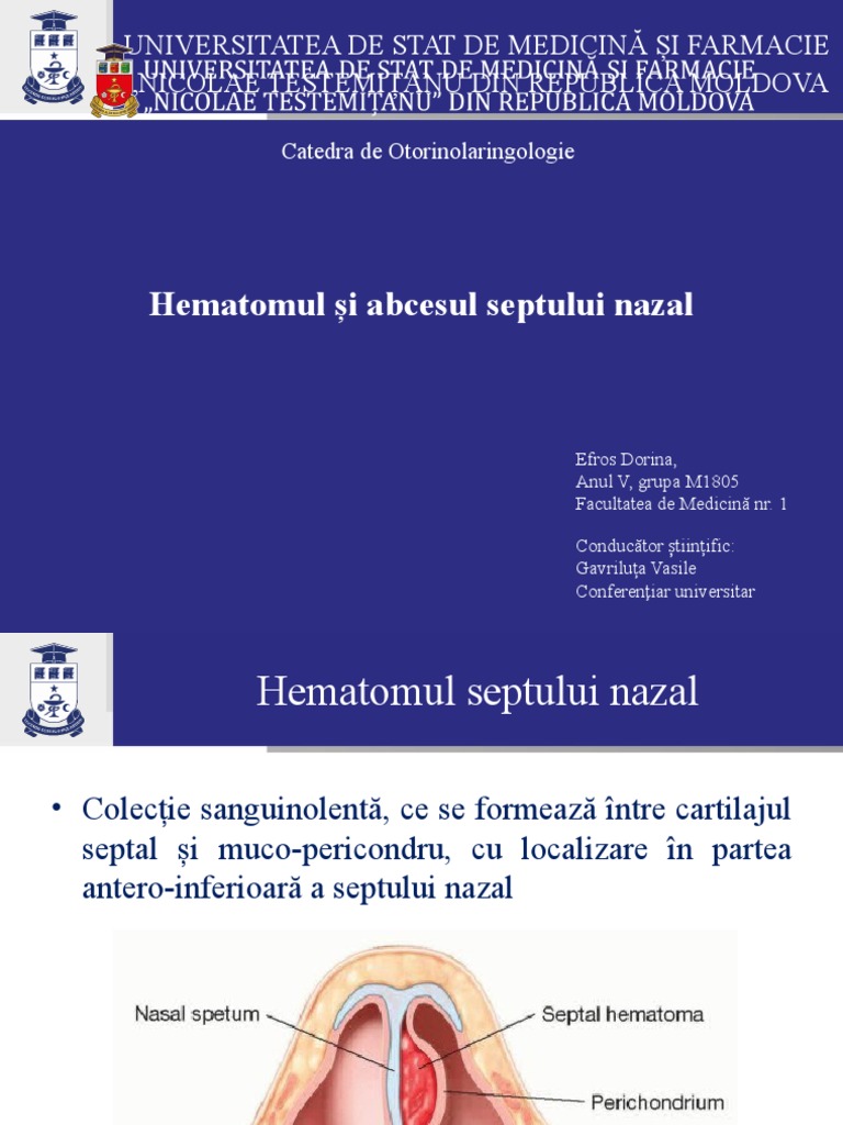Hematom Abces Septal | PDF