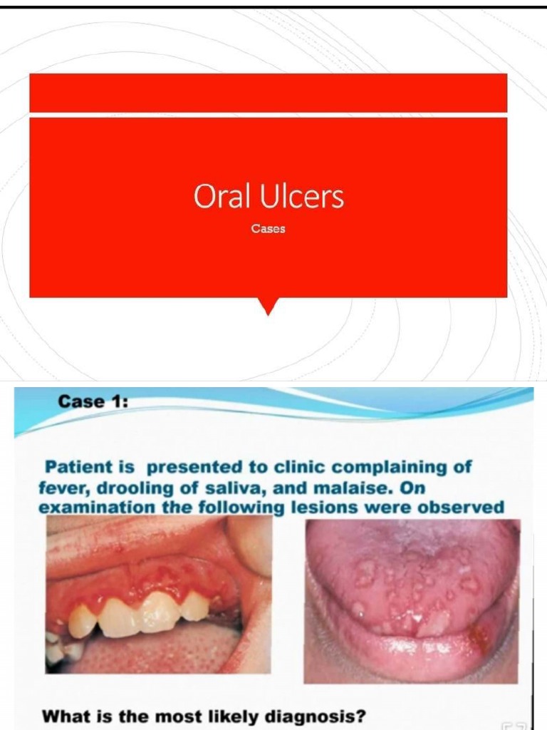 Practical Cases Oral Medicine PDF | PDF