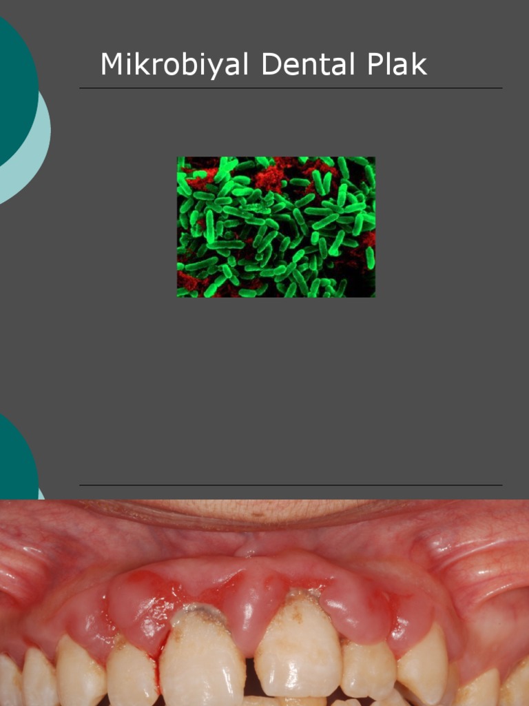 Mikrobiyal Dental Plak.pdf | PDF