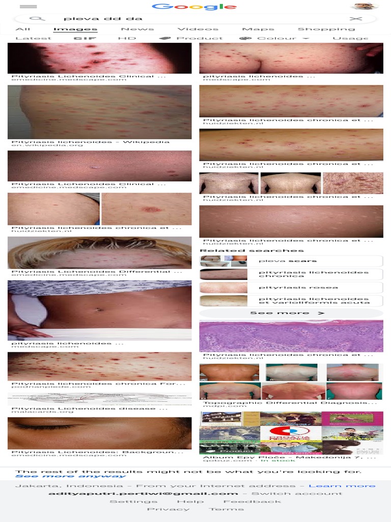 pleva dd da - Google Search.pdf | PDF | Dermatology | Medical Specialties