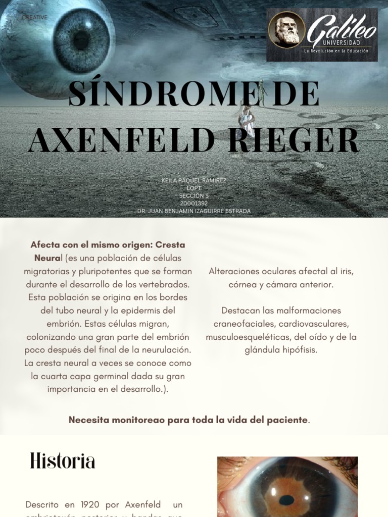 Sindrome de Axenfeld-Rieger PDF | PDF | Anatomía | Medicina CLINICA