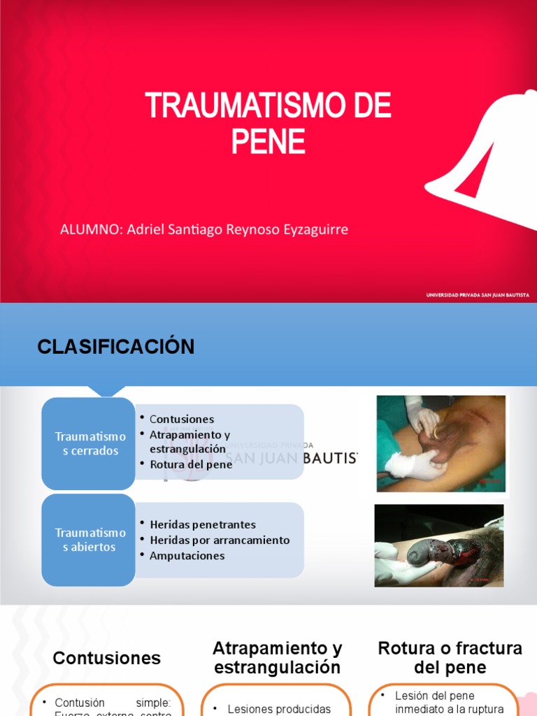 Expo Trauma Pene) | PDF | Lesión | Especialidades Medicas