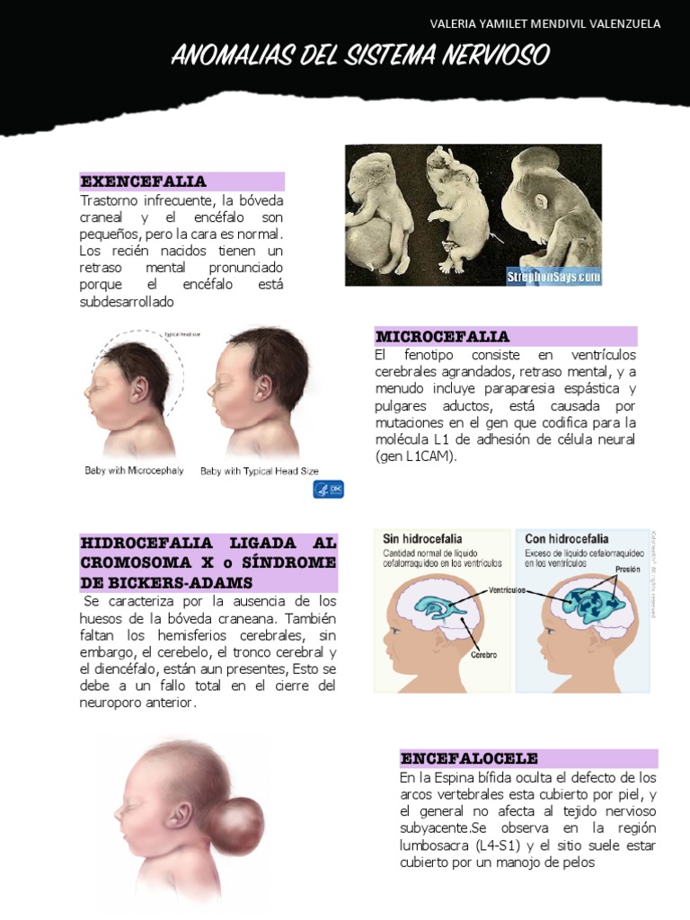 Anomalias Sistema Nervioso | PDF | Cerebro | Médula espinal
