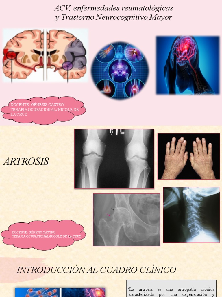 Acv, Enf Reuma, Trastorno Neurocognitivo Mayor | PDF