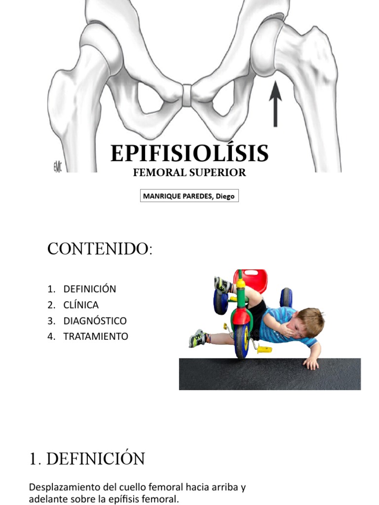 EPIFISIOLÍSIS | PDF | Rodilla | Epidemiología