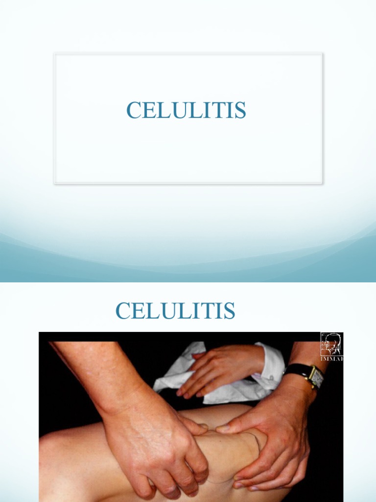 Celulitis: Anatomía y Tratamientos | PDF