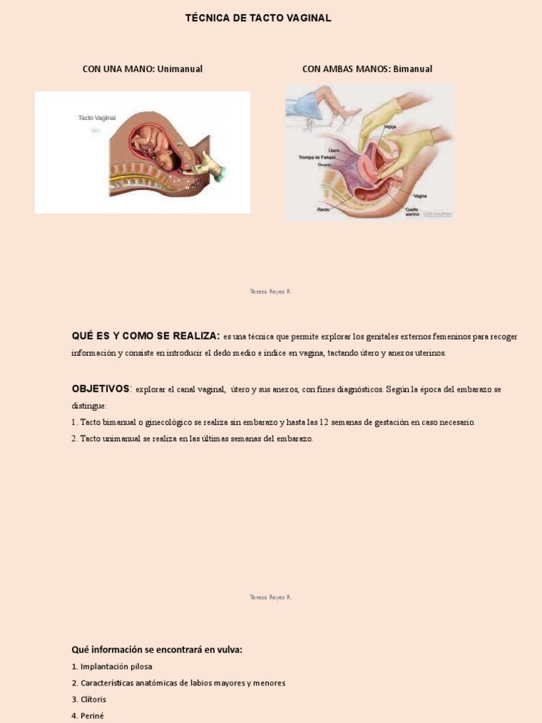 Tacto Vaginal 2023 | PDF | Vagina | El embarazo