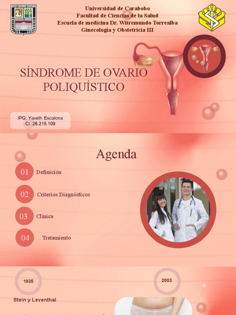 Sindrome de Ovario Poliquistico | PDF