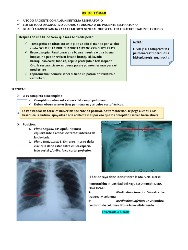 Radiografía de Tórax | PDF