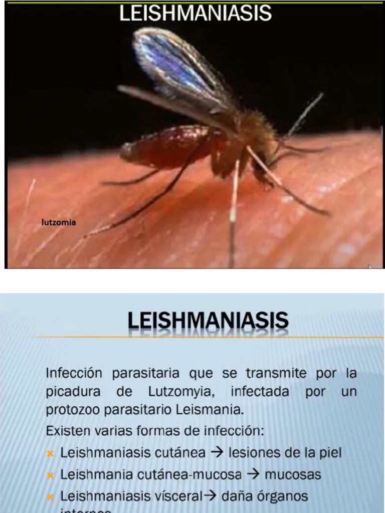 Formas y diagnóstico de leishmaniasis | PDF