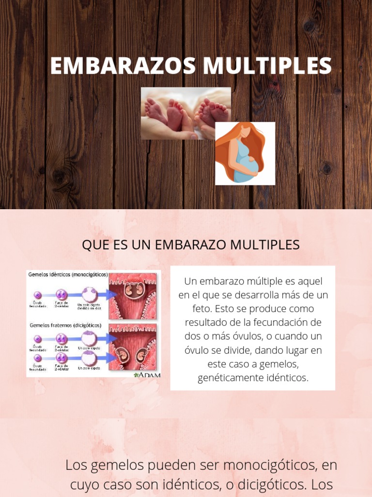 Embarazos Multiples | Descargar gratis PDF | Parto prematuro | El embarazo