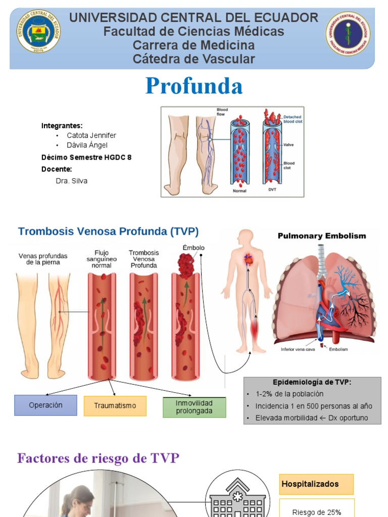 Trombosis Venosa Profunda | PDF | Medicina CLINICA | Especialidades Medicas