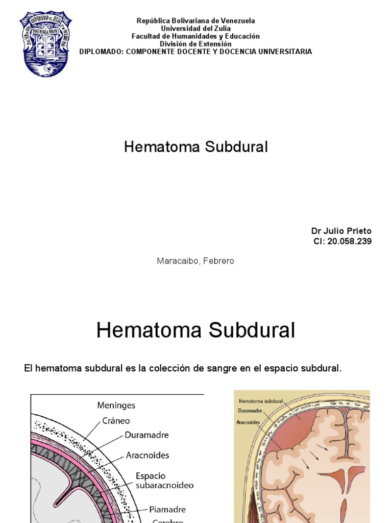 Hematoma Subdural | PDF