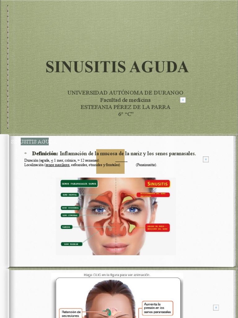 Sinusitis Aguda | PDF | Especialidades Medicas | Medicina CLINICA