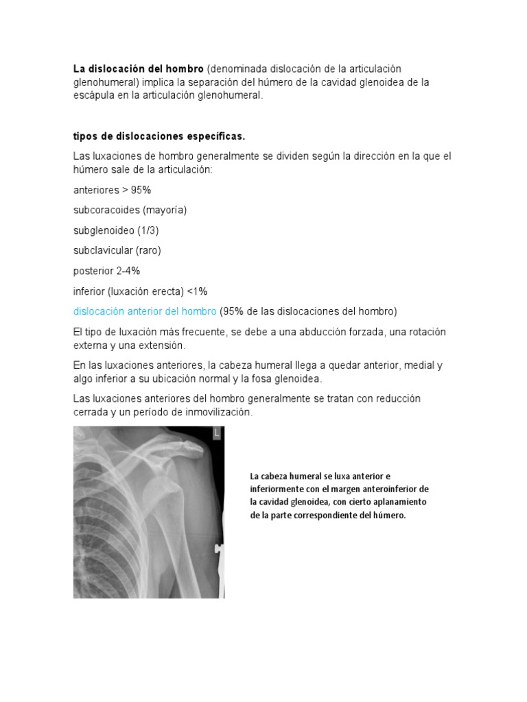 Tipos de dislocación del hombro y tratamiento | PDF | Hombro | Anatomía ...