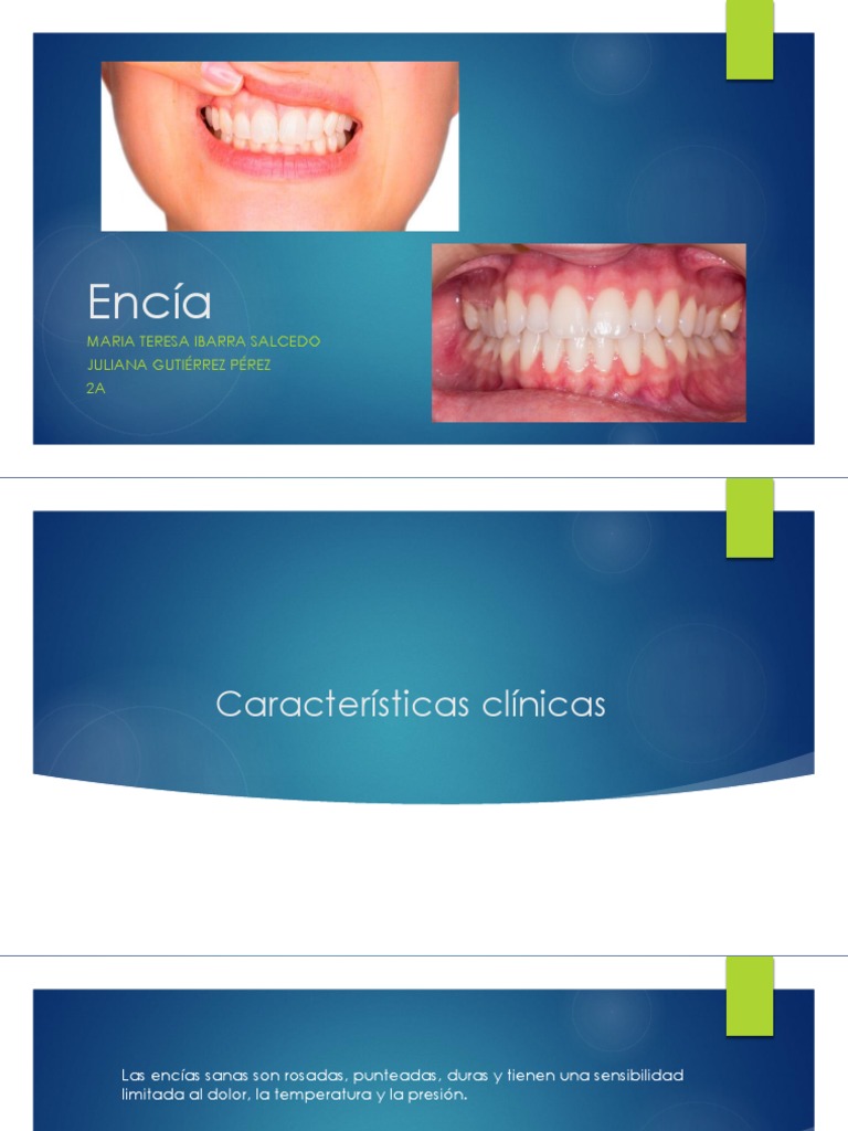 Encía PDF | PDF | Morfología (biología) | Anatomía