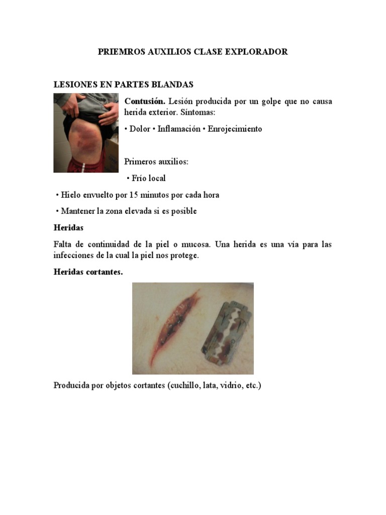 Priemros Auxilios Clase Explorador | PDF