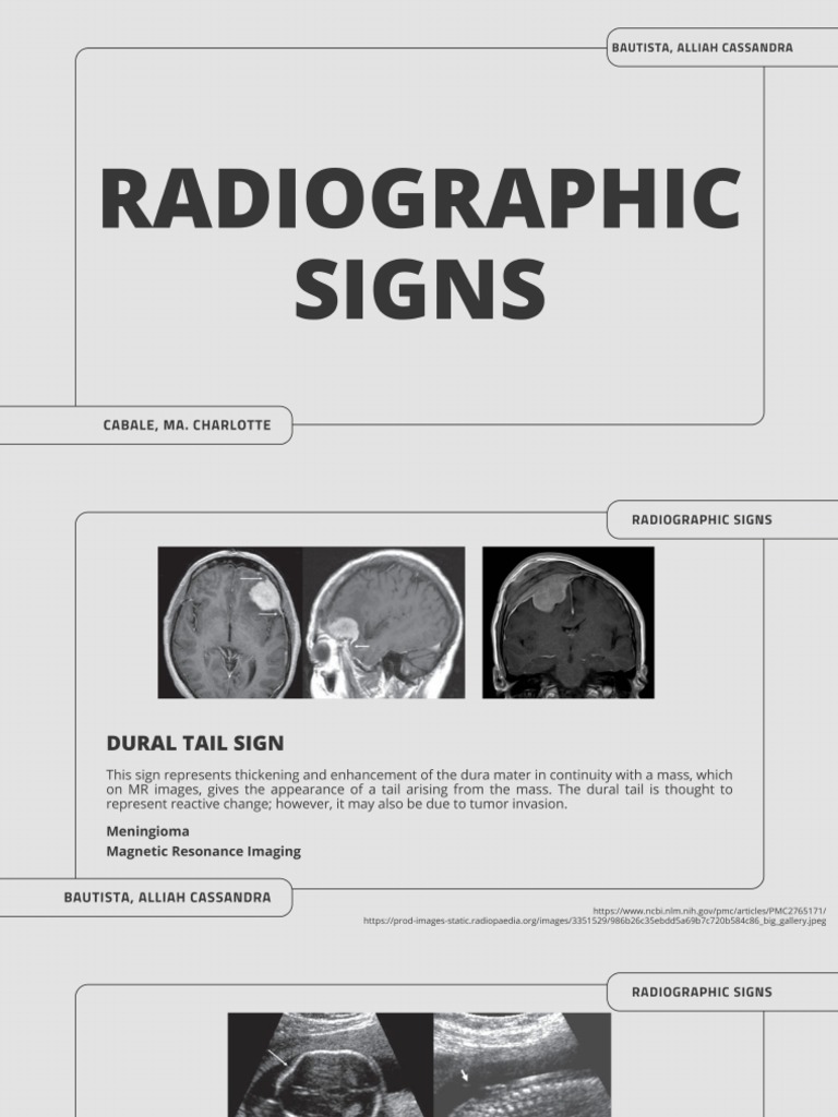 Radiographic Signs | PDF