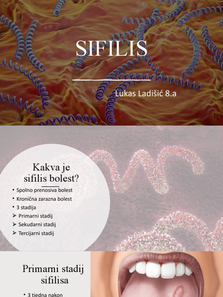 Sifilis | PDF