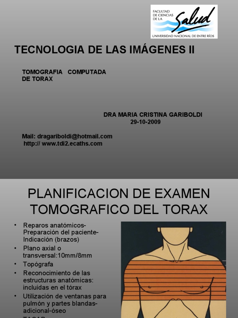 TC de Torax | PDF | Tórax | Pulmón