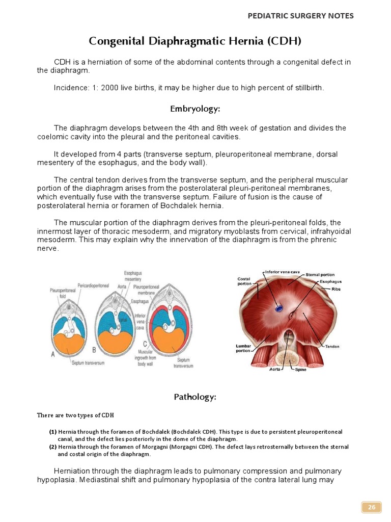 Congenital Diaphragmatic Hernia | PDF | Clinical Medicine | Human ...