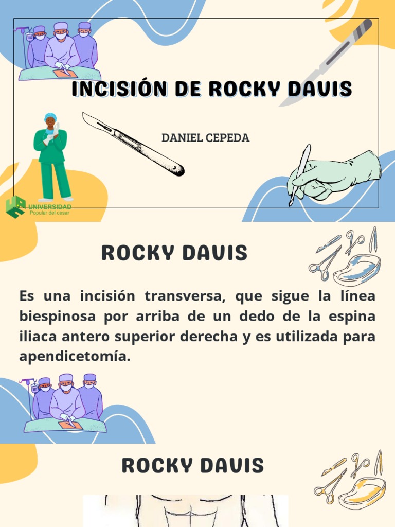 Incisión Rocky Davis | PDF | Medicina CLINICA | Anatomía