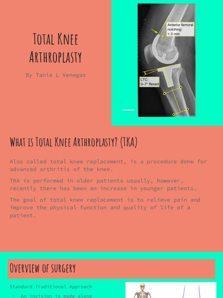 Total Knee Arthroplasty | PDF | Knee | Musculoskeletal System
