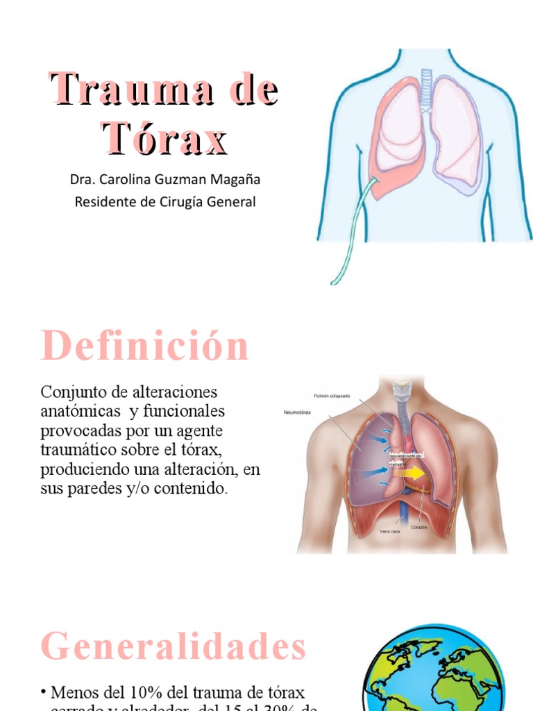 Trauma de Tórax | PDF