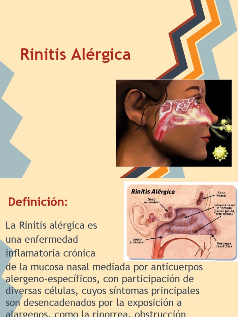 Rinitis Alergica | PDF | Alergia | Asma