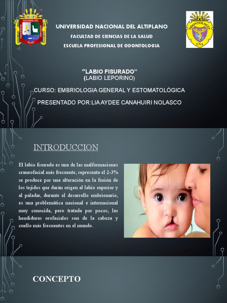 Labio Fisurado | PDF | Especialidades Medicas | Medicina CLINICA