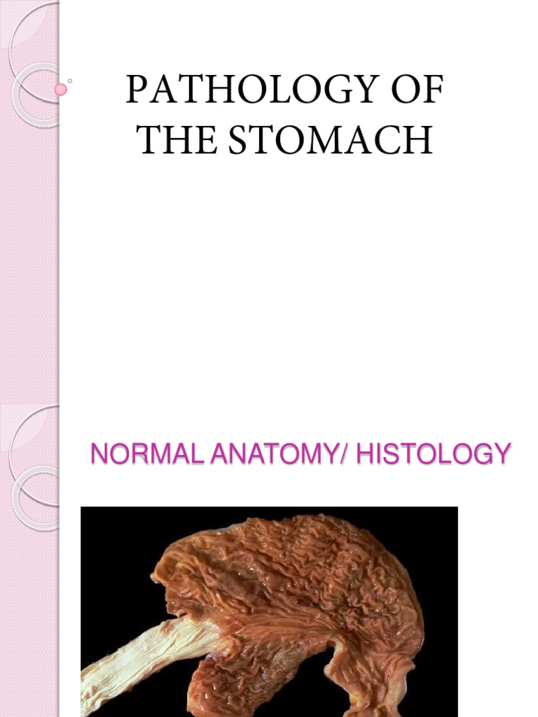 Stomach Pathology | PDF | Stomach | Autoimmune Disease