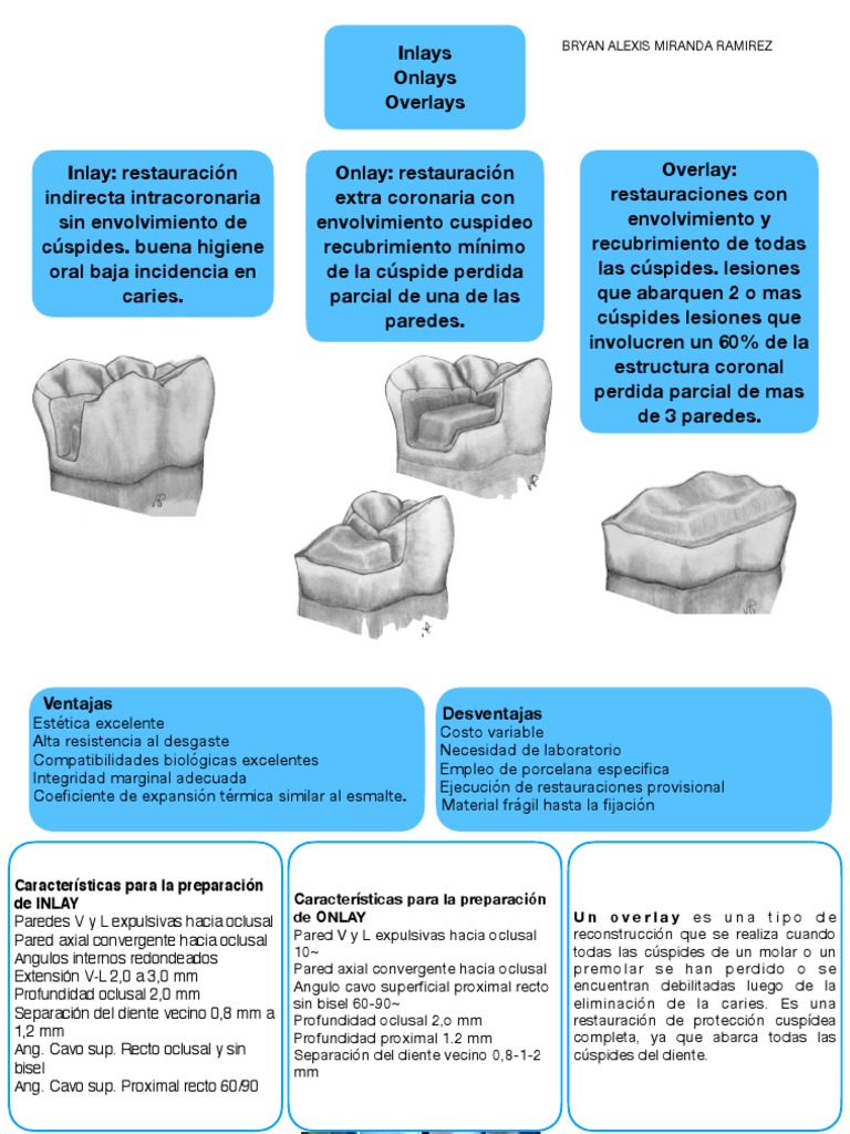 Preparación de Inlays, Onlays y Overlays | PDF | Ramas de Odontología ...