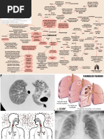 Tuberculose Pulmonar | PDF | Tuberculose | Mycobacterium tuberculosis