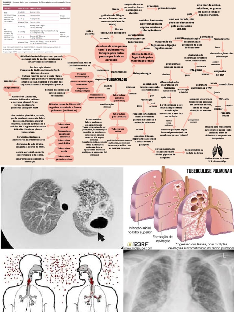 Tuberc Mapa | PDF | Mycobacterium tuberculosis | Medicina Clínica