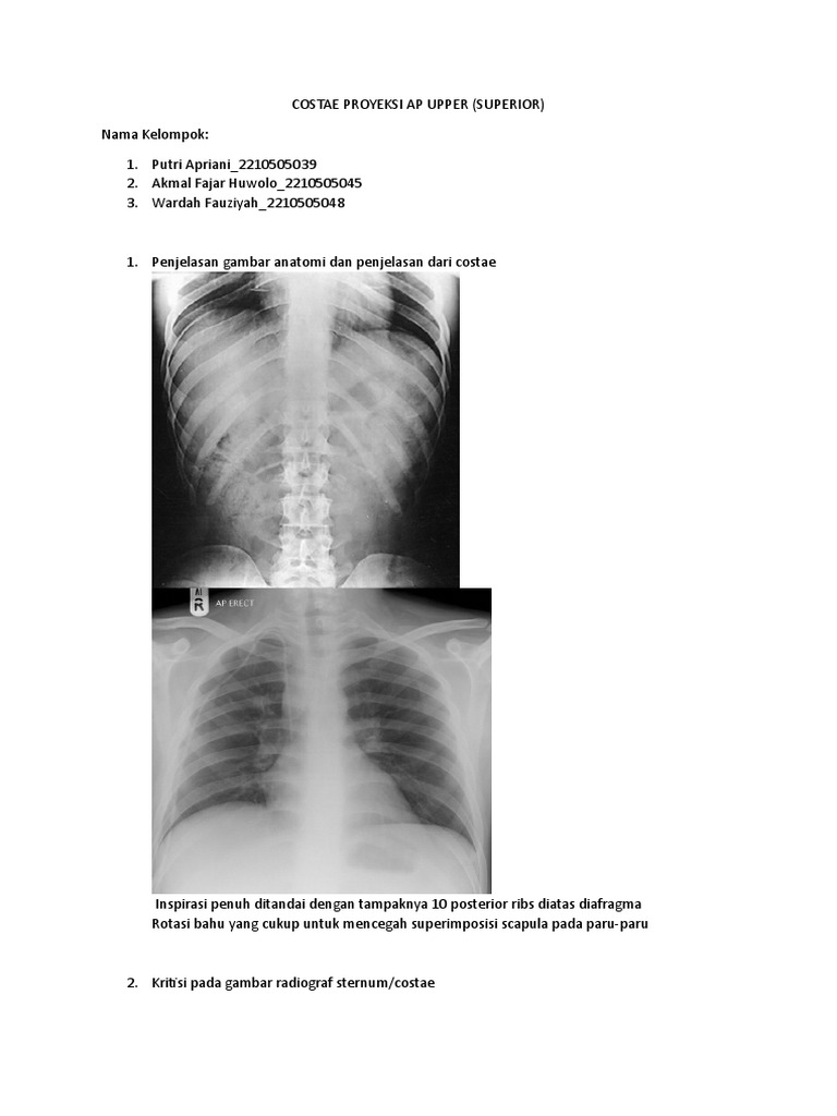 Proyeksi AP Upper Costae | PDF