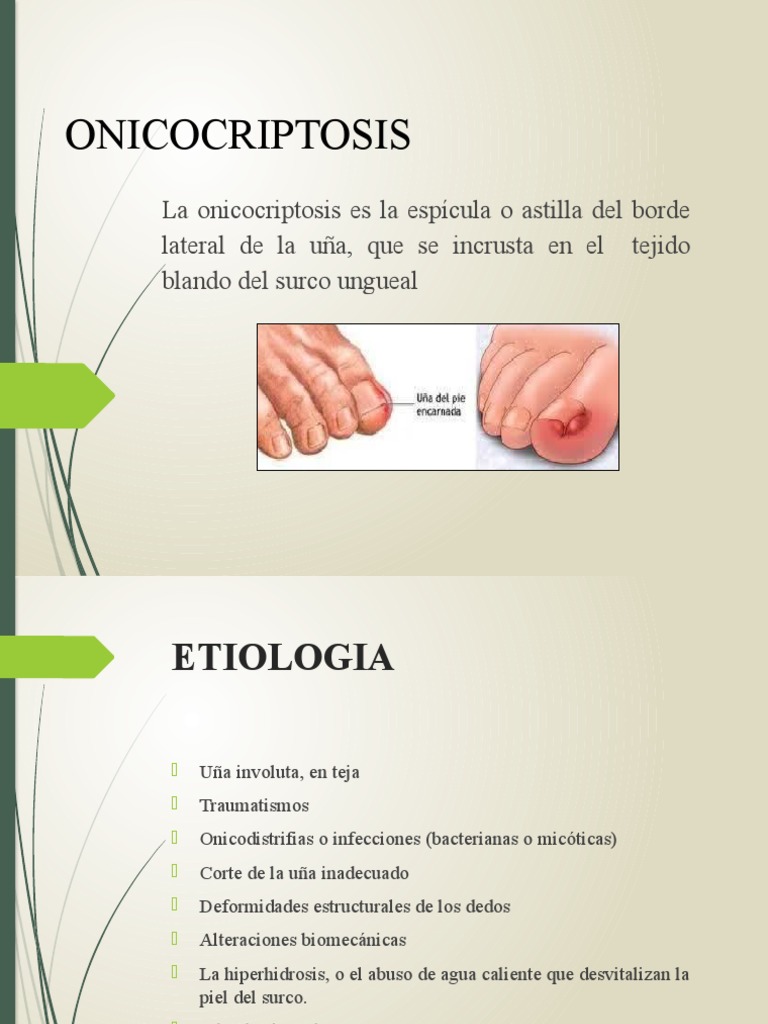 ONICOCRPTOSIS | PDF