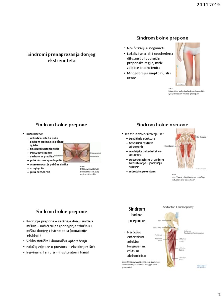 3sindromi Prenaprezanja Noga | PDF