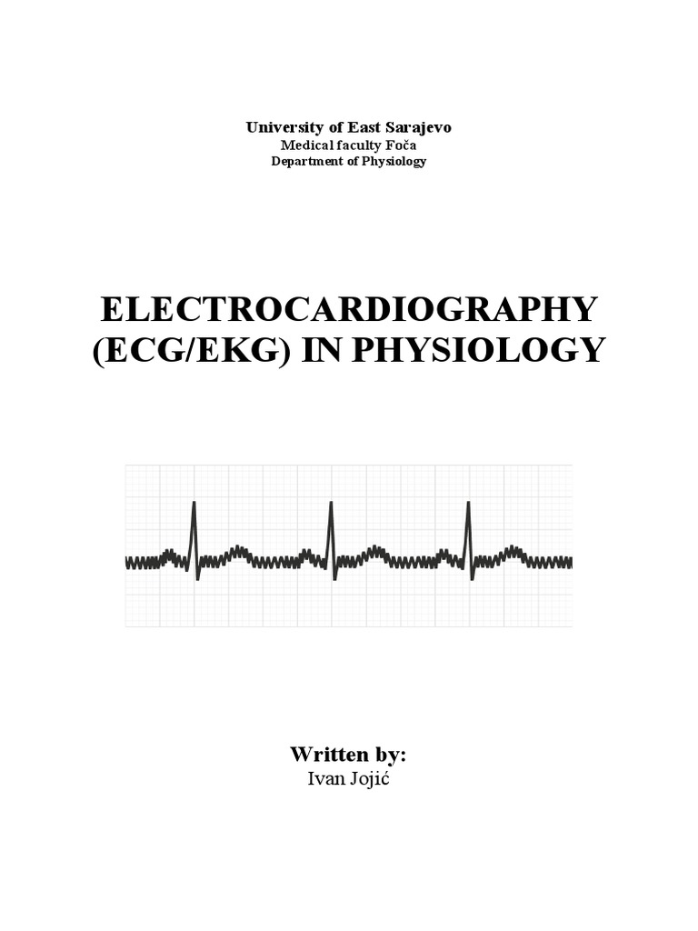 Ecg (Ekg) Script | PDF