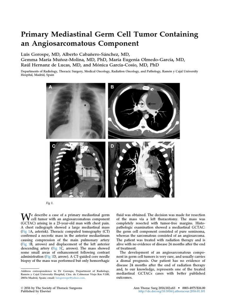 Primary Mediastinal Germ Cell Tumor Containing Pdf Medicine