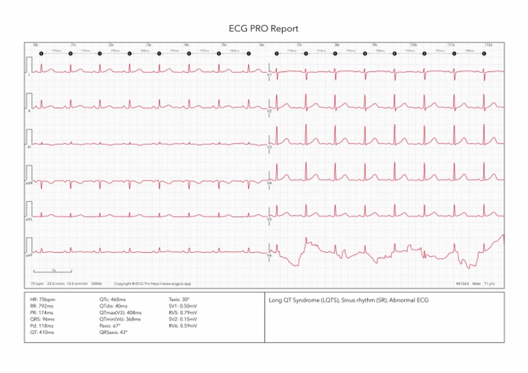 ECG Pro Report 51063 | PDF
