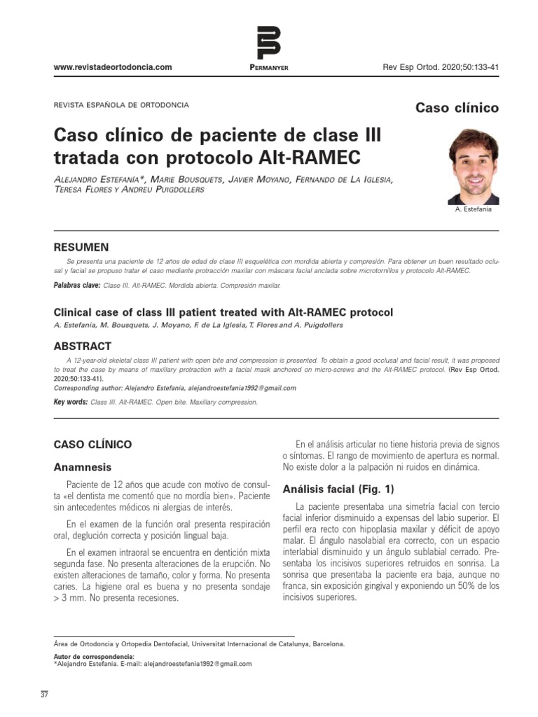 Caso Clínico de Paciente de Clase III Tratada Con Protocolo Alt-RAMEC | PDF | Ortodoncia | Boca