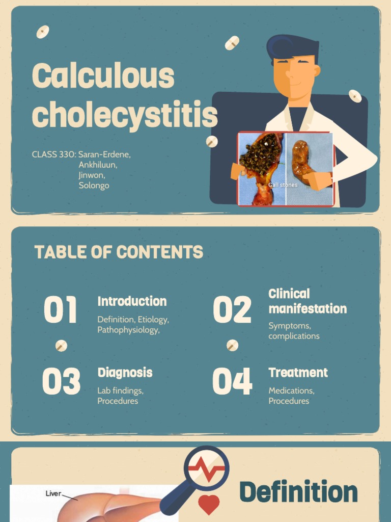 Calculous Cholecystitis | PDF | Science & Mathematics