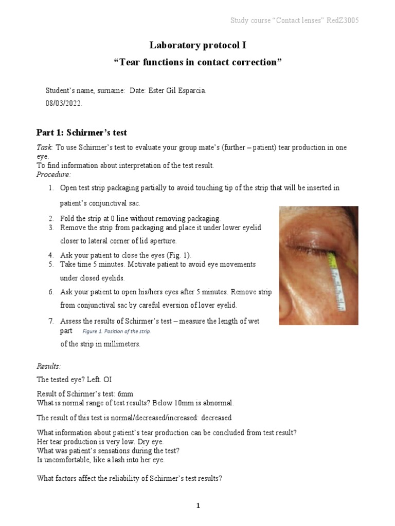 Schirmer's Test for Tear Production Evaluation | PDF | Science ...